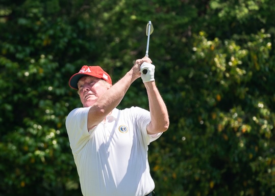 Trump Says His Chronic Venous Insufficiency Makes It Impossible For Him ...